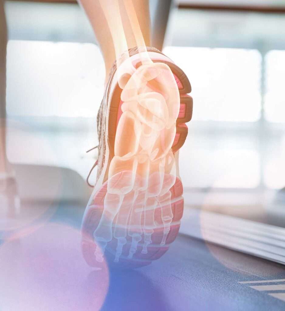 Insole Making Process - Boyner Clinic